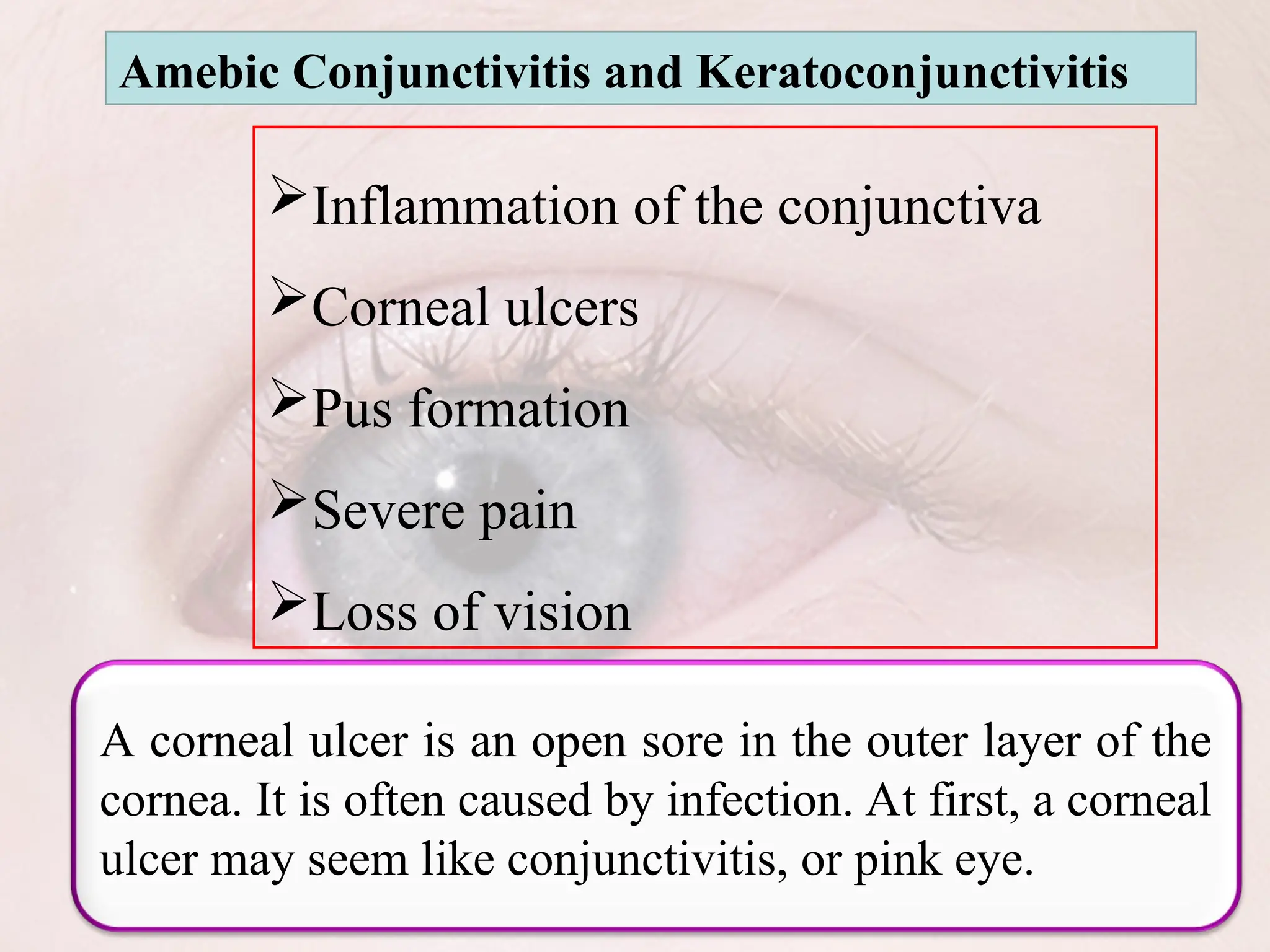 Eyes Infection (conjunctivitis) . | PPT | Eye and Vision Conditions ...