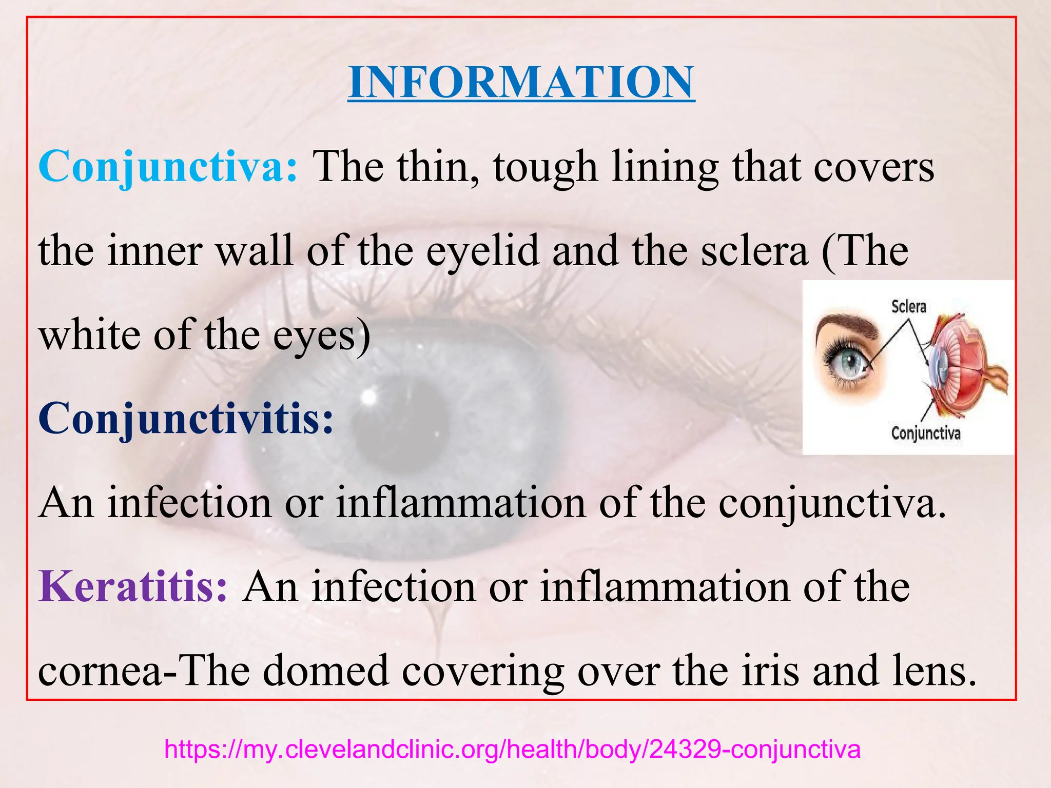 Eyes Infection (conjunctivitis) . | PPT | Eye and Vision Conditions ...