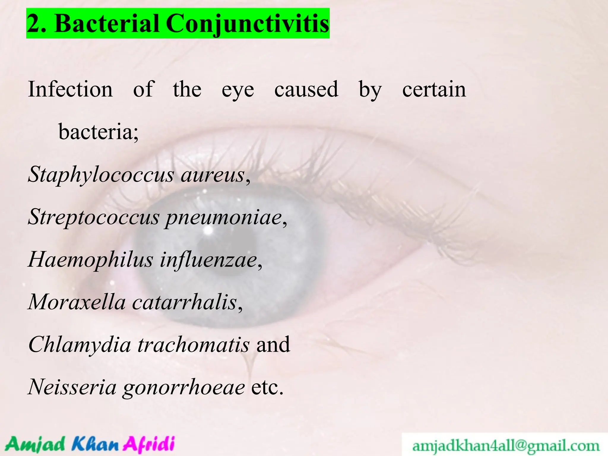 Eyes Infection (conjunctivitis) . | PPT