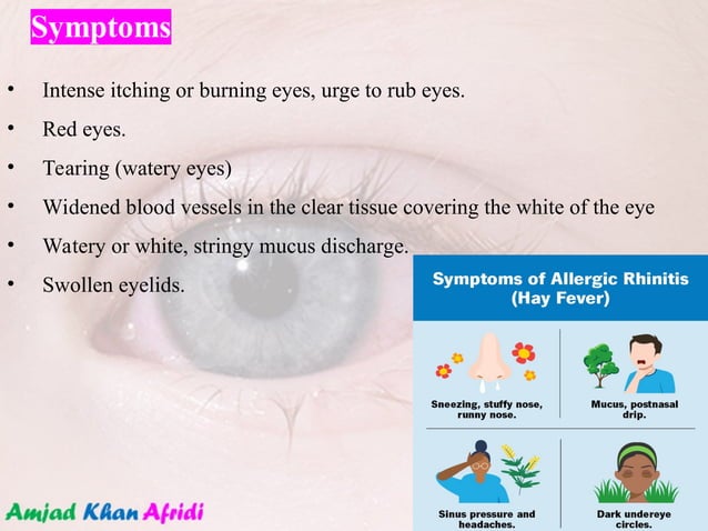Eyes Infection (conjunctivitis) . | PPT | Eye and Vision Conditions ...