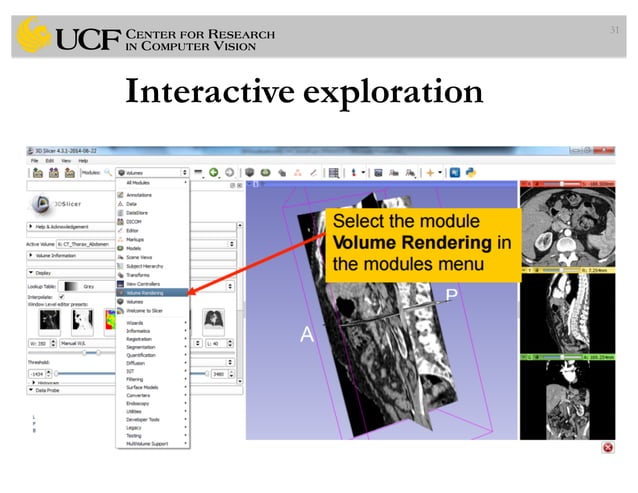 Lec1 Medical Image Computing Introduction Ppt