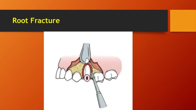 complications of tooth extraction | PPTX