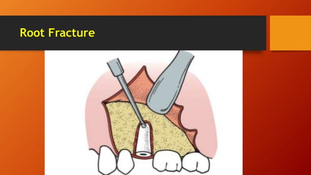 complications of tooth extraction | PPTX