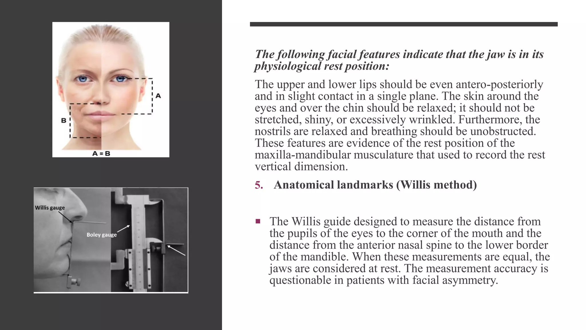 Maxillo-mandibular relation | PDF