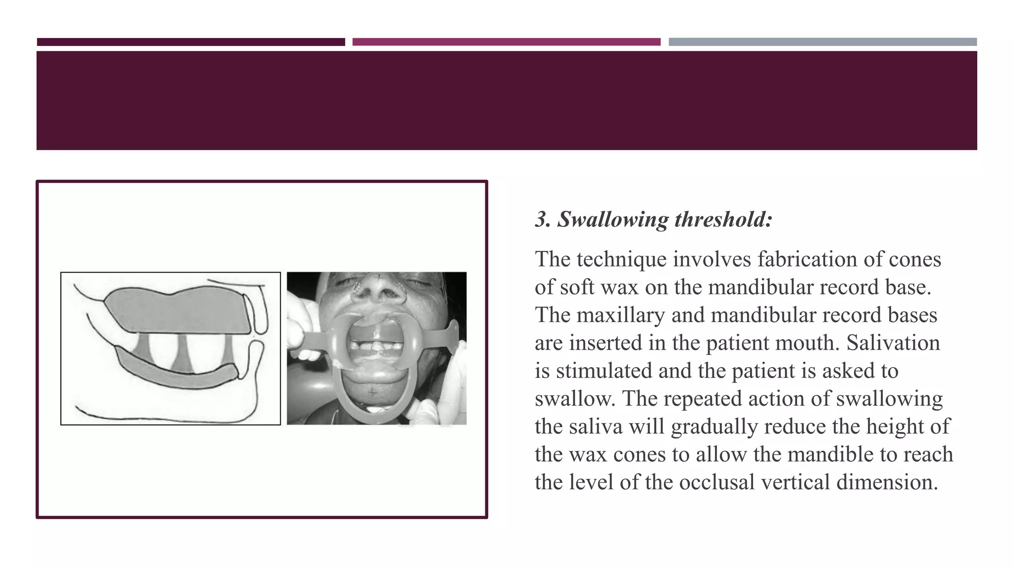 Maxillo-mandibular relation | PDF