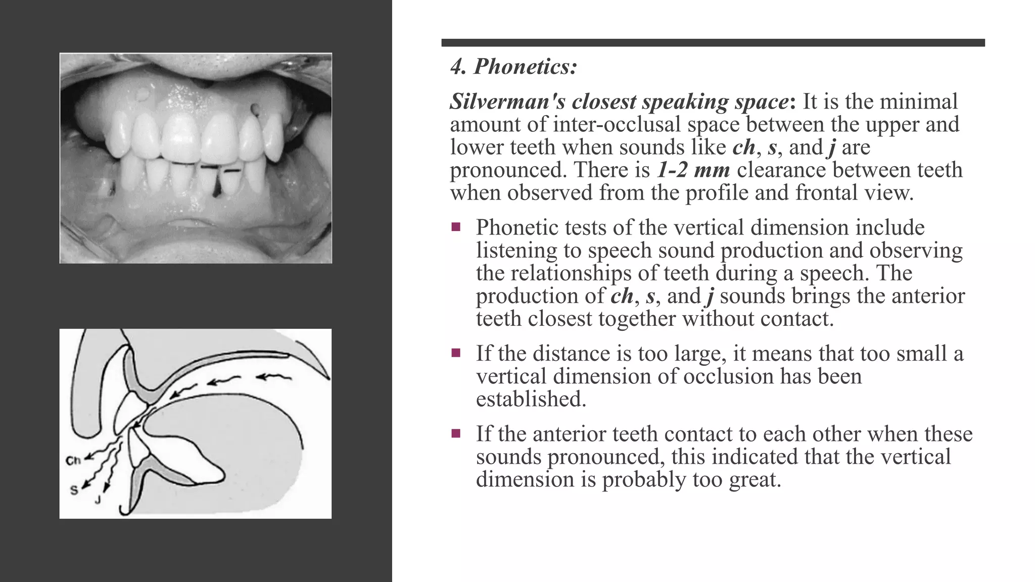 Maxillo-mandibular relation | PDF