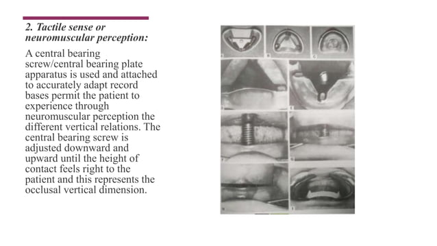 Maxillo-mandibular relation | PDF | Dental Health | Diseases and Conditions