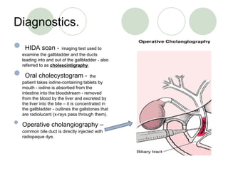 LEC12-cholecystitis-cholelithiasis.power point | PPT