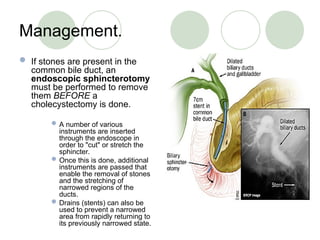 LEC12-cholecystitis-cholelithiasis.power point | PPT