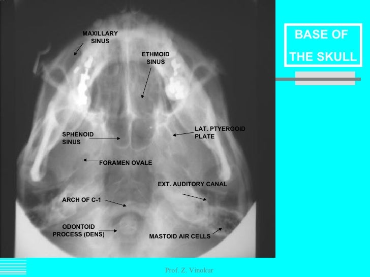 Lec1222509slideshare
