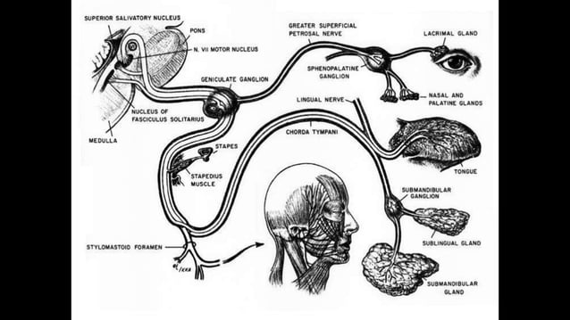 lec 12 Neuritis of facial nerve. Trigeminal neuralgia.Glossopharyngeal ...