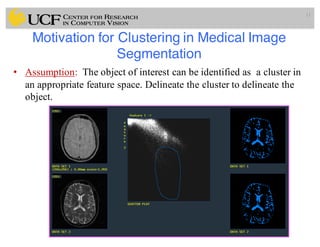 Lec13: Clustering Based Medical Image Segmentation Methods | PDF