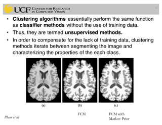 Lec13: Clustering Based Medical Image Segmentation Methods | PDF