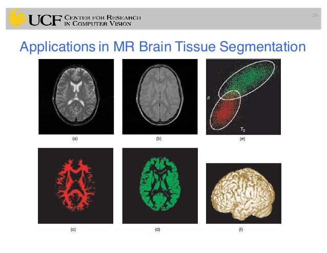 Lec13 Clustering Based Medical Image Segmentation Methods