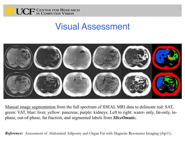 Lec14: Evaluation Framework for Medical Image Segmentation | PPT