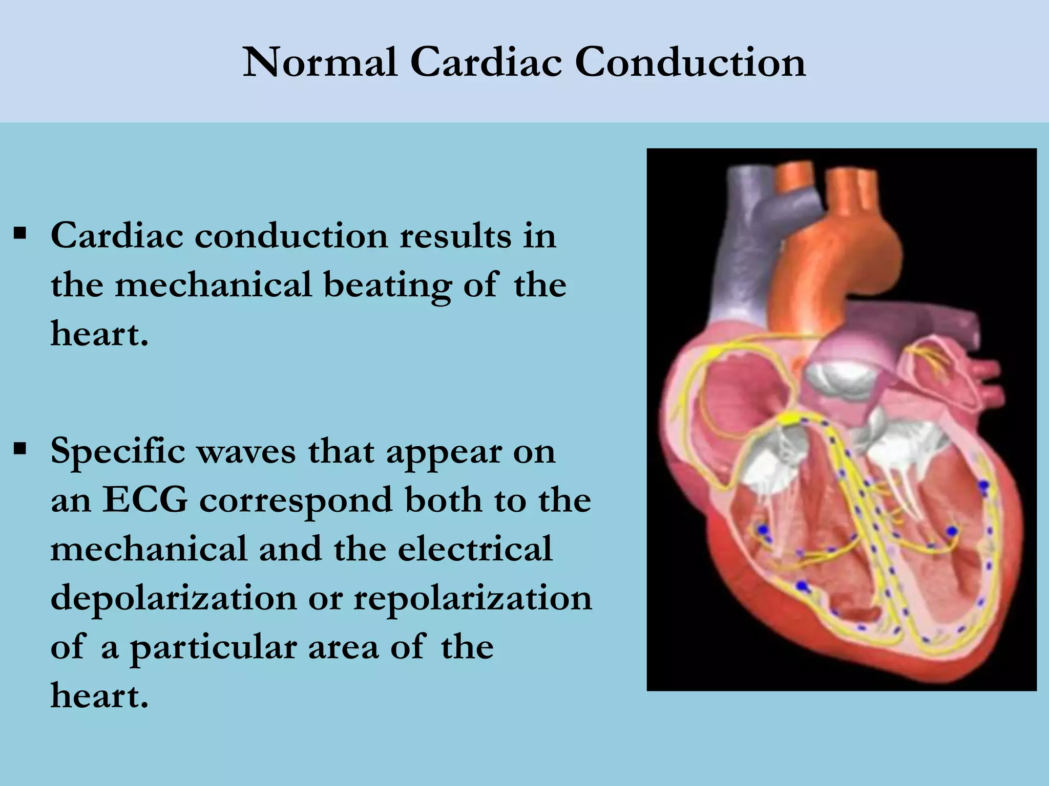 Lec 14 basic ecg interpretation for mohs | PPTX