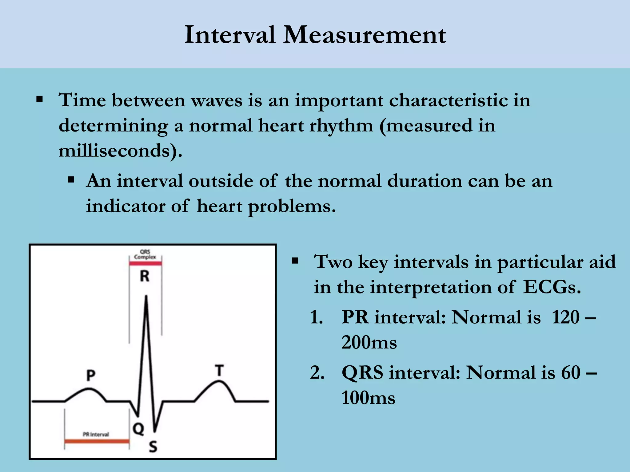 Lec 14 basic ecg interpretation for mohs | PPTX
