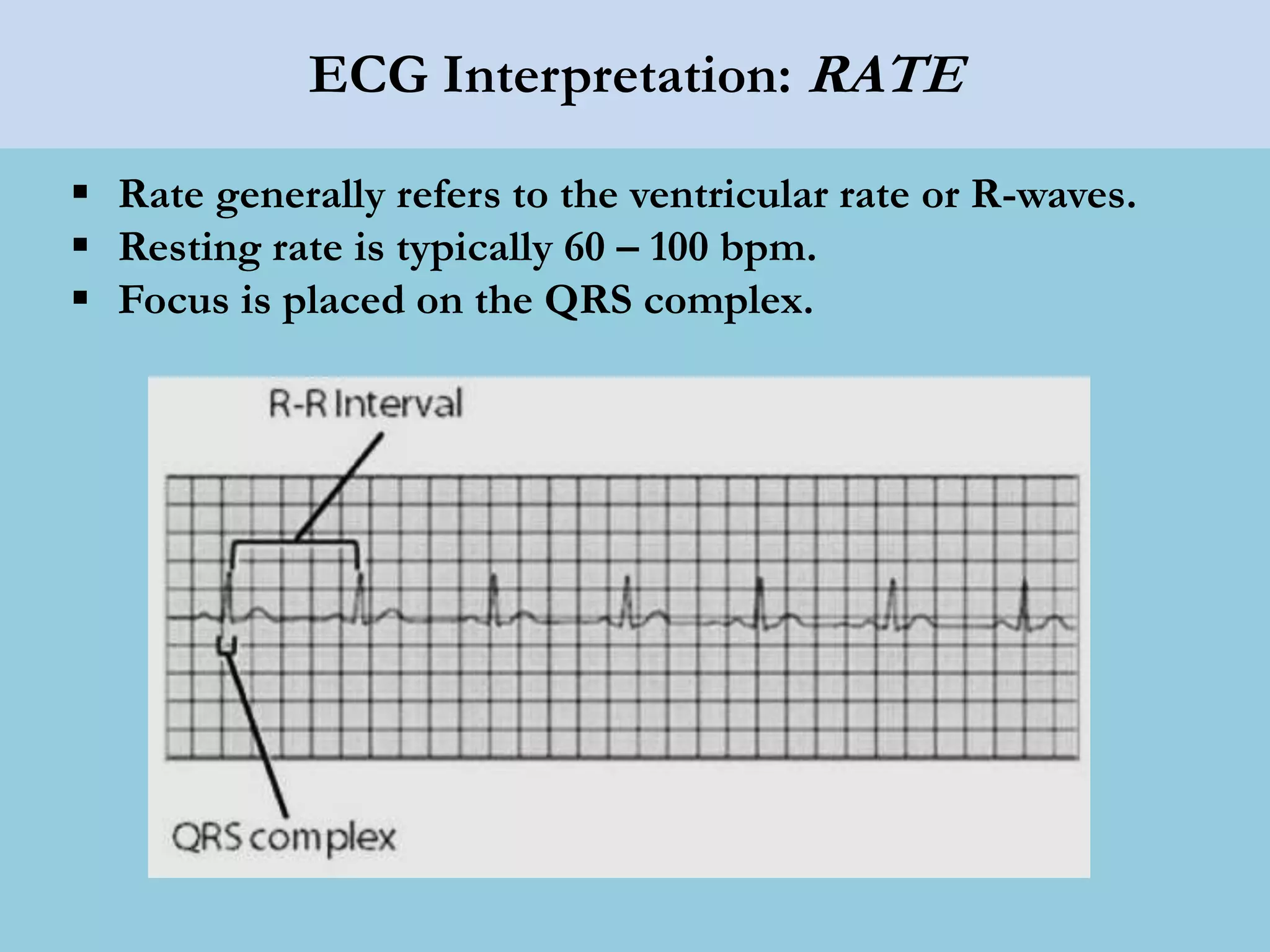 Lec 14 basic ecg interpretation for mohs | PPTX