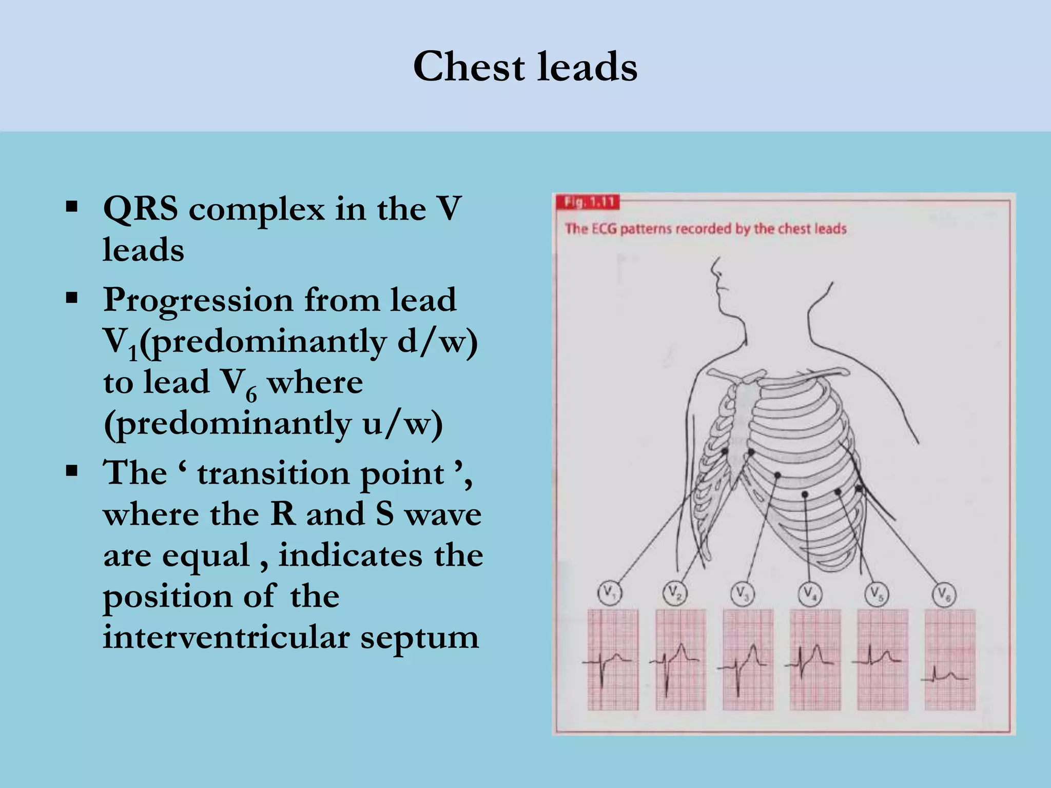 Lec 14 basic ecg interpretation for mohs | PPTX