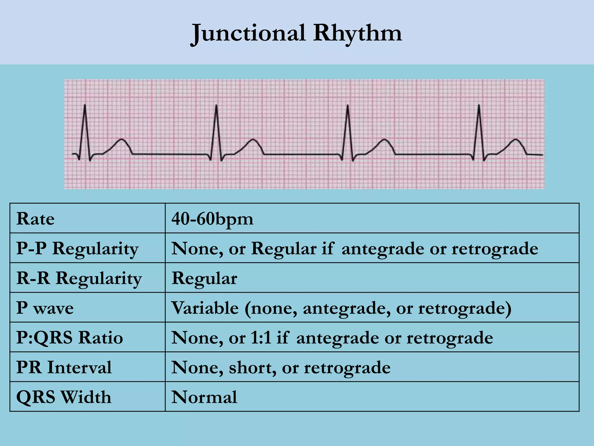 Lec 14 basic ecg interpretation for mohs | PPTX