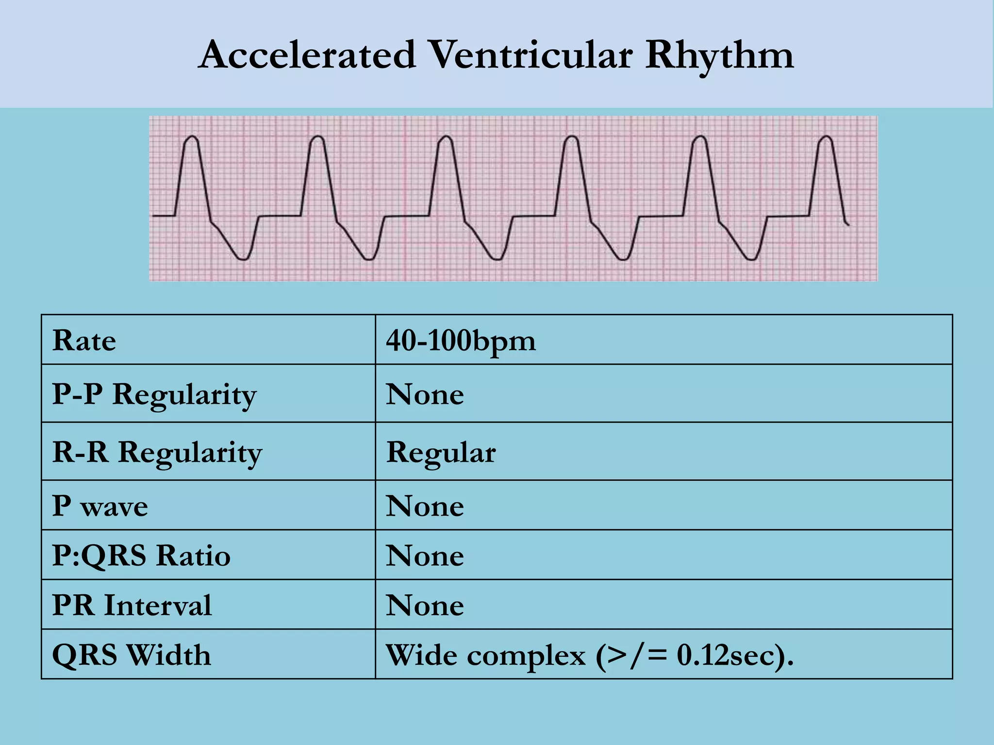 Lec 14 basic ecg interpretation for mohs | PPTX