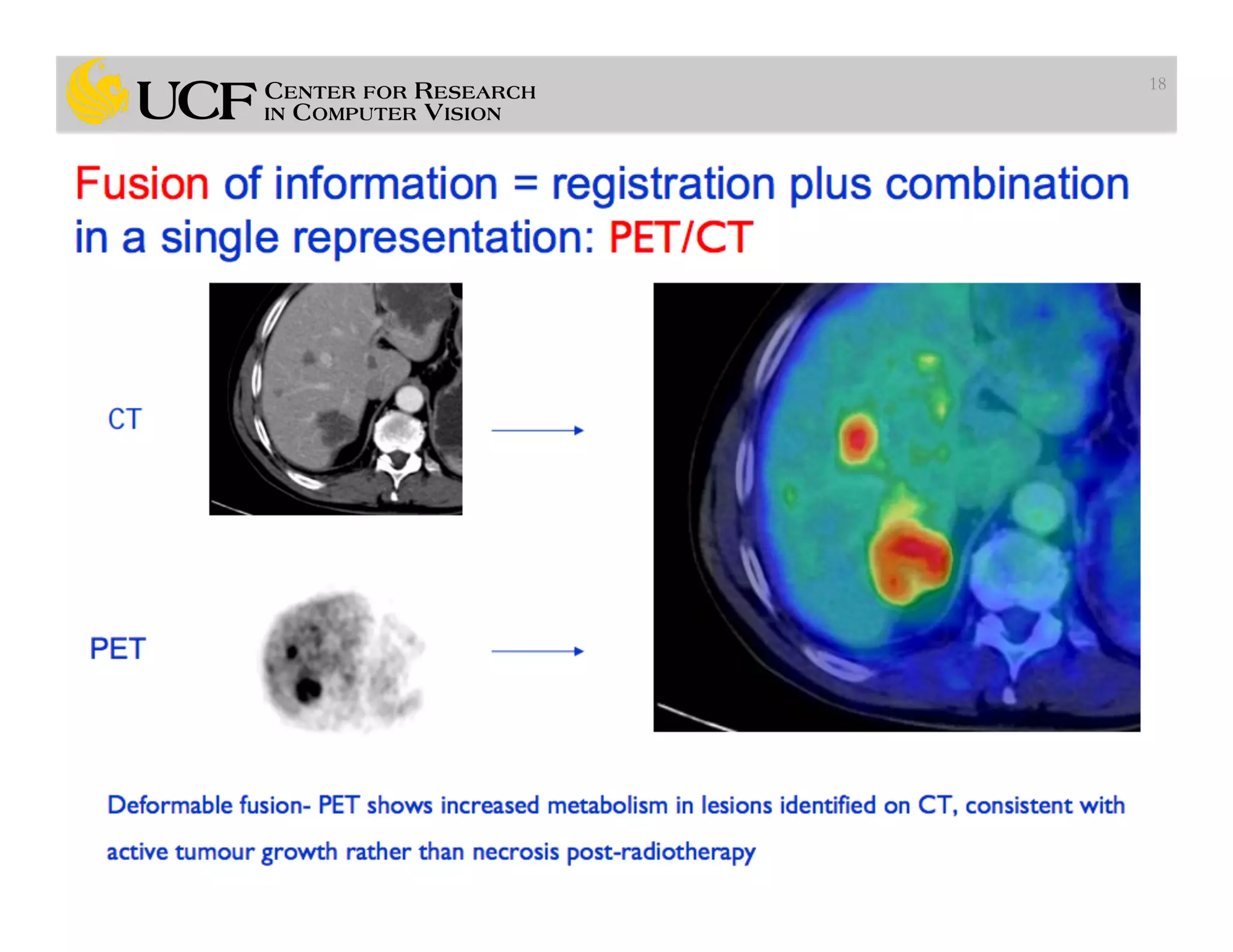 Lec15: Medical Image Registration (Introduction) | PDF