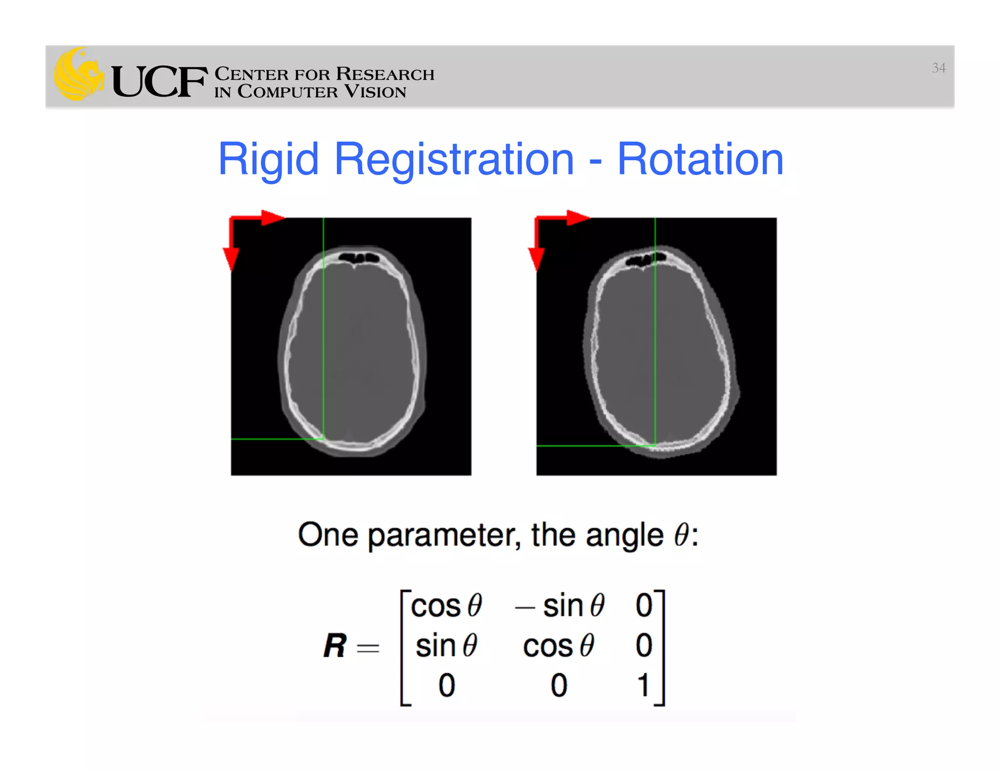Lec15: Medical Image Registration (Introduction) | PDF