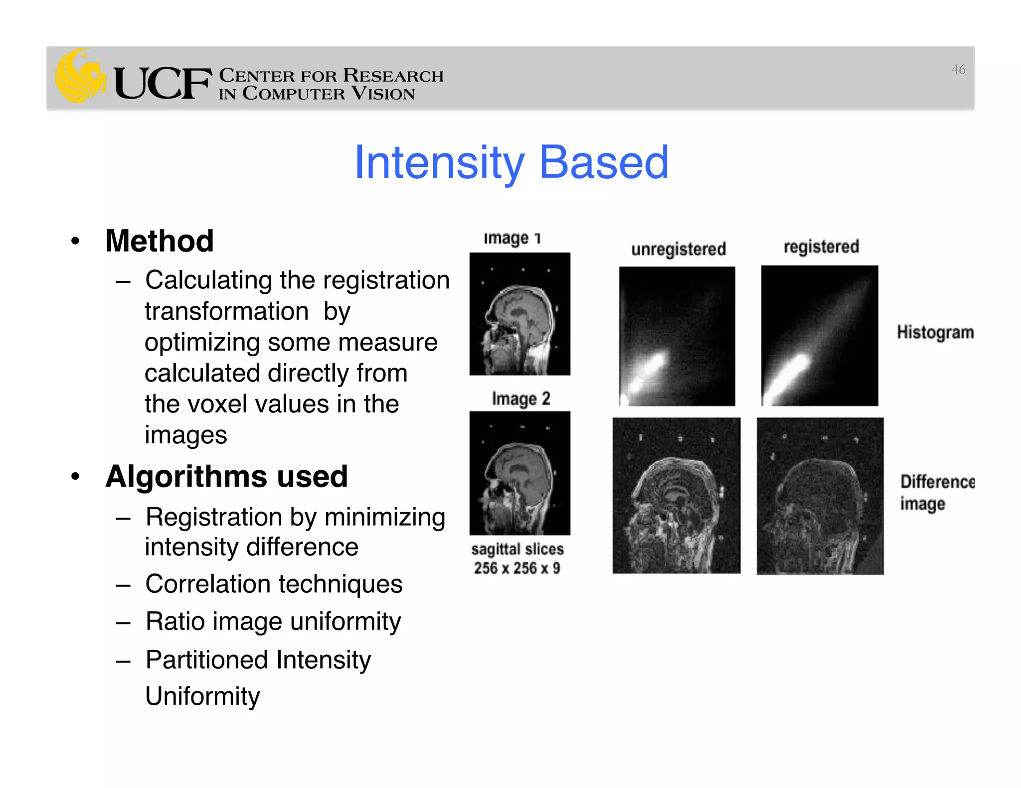 Lec15: Medical Image Registration (Introduction) | PDF