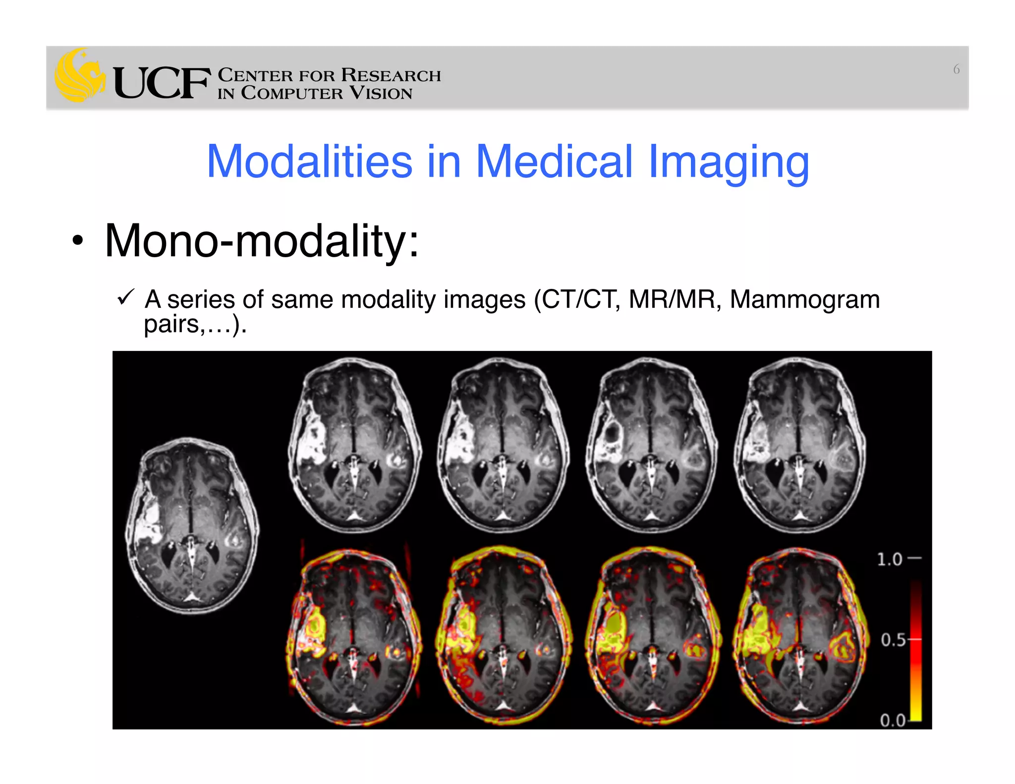Lec15: Medical Image Registration (Introduction) | PDF