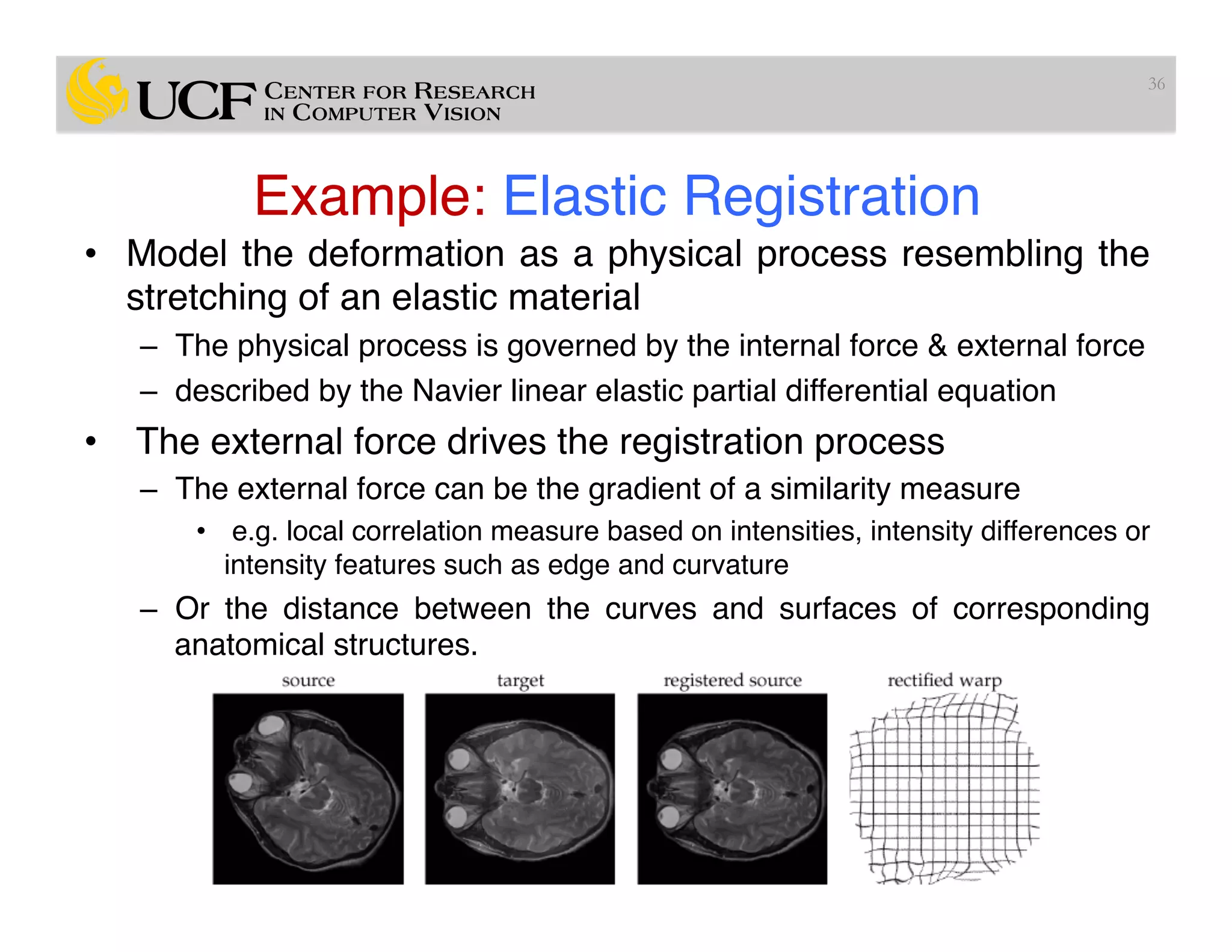 Lec16: Medical Image Registration (Advanced): Deformable Registration | PDF