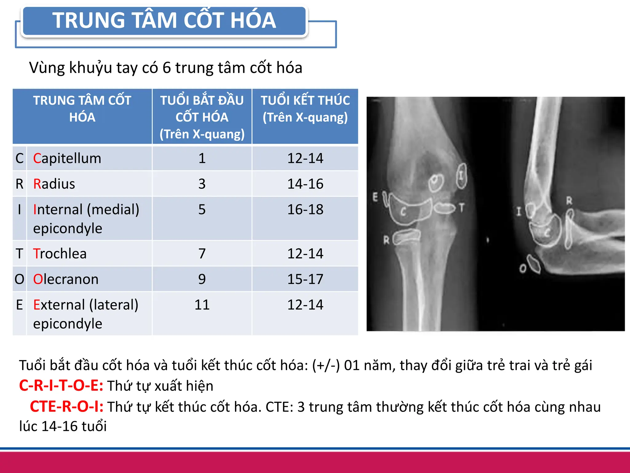LEC 16 Y4_GaÌ y TLC xuÌ oÌ ng caÌ nh tay oÌ Ì treÌ em.pptx