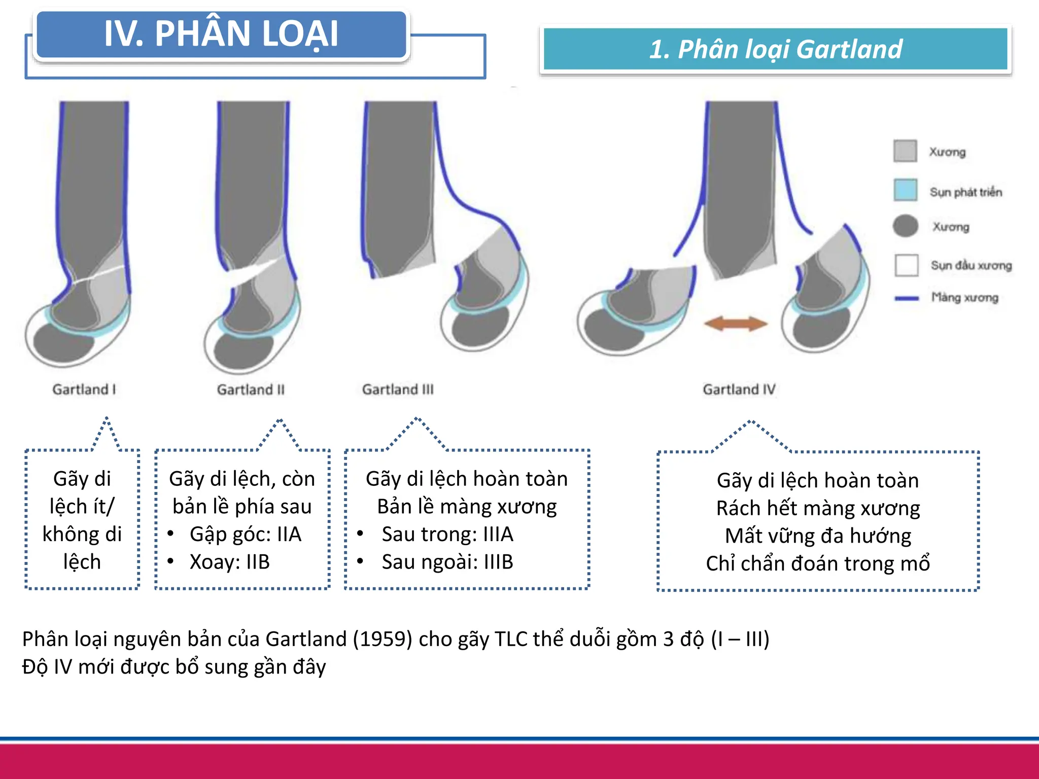 LEC 16 Y4_GaÌ y TLC xuÌ oÌ ng caÌ nh tay oÌ Ì treÌ em.pptx