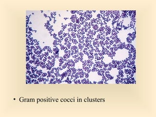 Streptococcus Pyogenes Slide