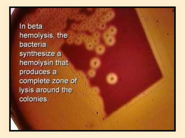 streptococci | PPT | Ear, Nose and Throat Conditions | Diseases and ...