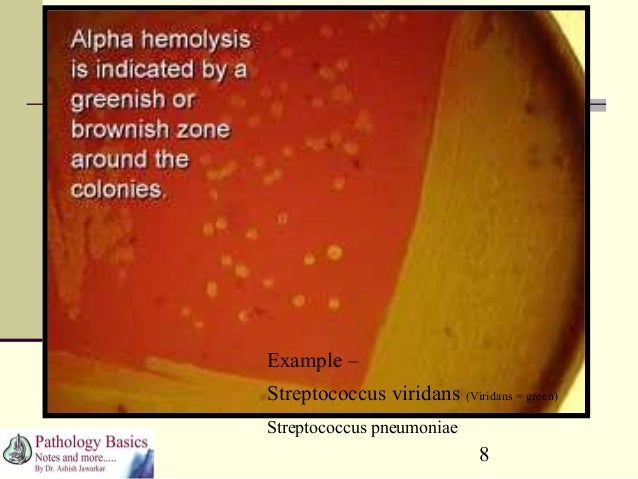 Streptococcus Pneumoniae Colony Morphology