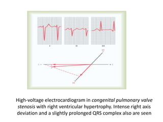Lec18(cvs) | PPTX