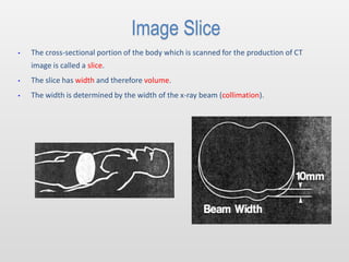 Lec1 Ali - CT Basics _ Physical Priniciples new.pptx