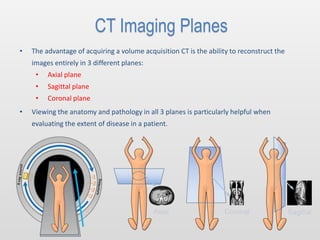 Lec1 Ali - CT Basics _ Physical Priniciples new.pptx
