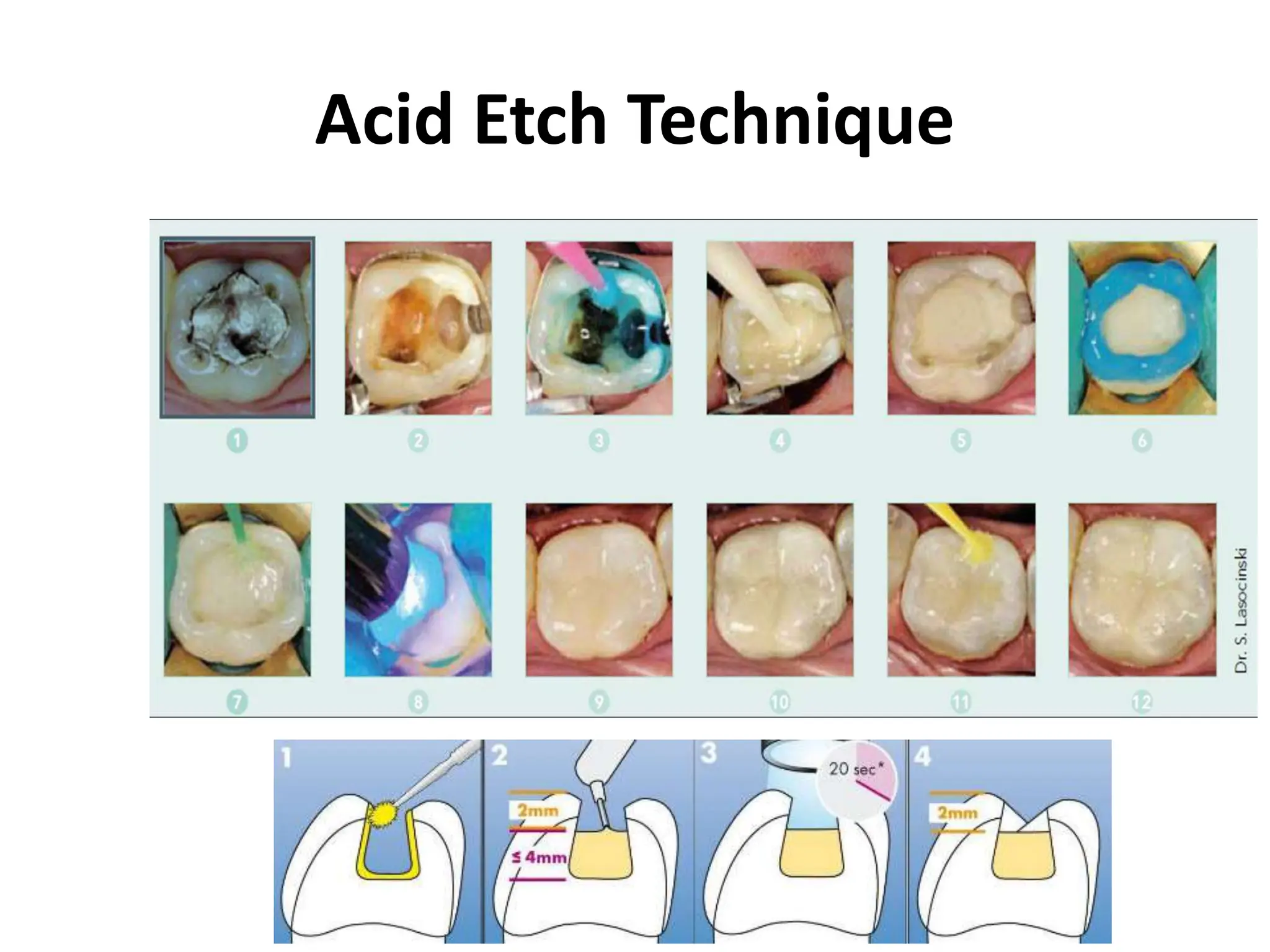 lec 1 Bonding to Dental Substrates or Adhesion.pptx