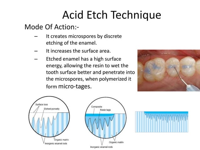 lec 1 Bonding to Dental Substrates or Adhesion.pptx
