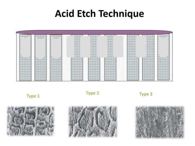 lec 1 Bonding to Dental Substrates or Adhesion.pptx