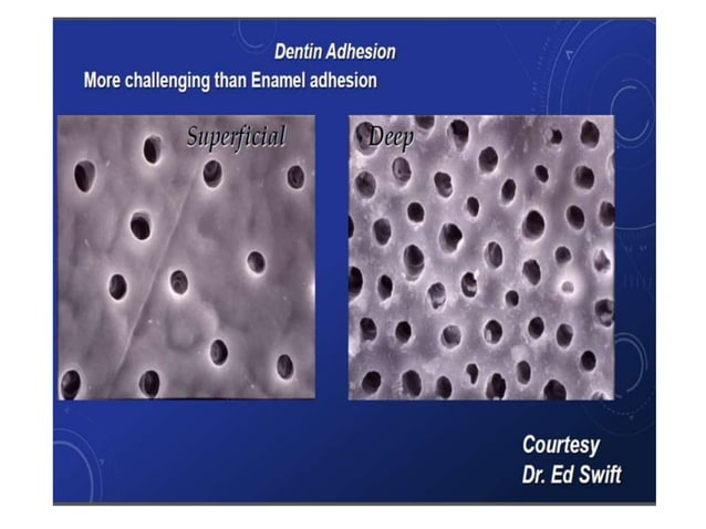 lec 1 Bonding to Dental Substrates or Adhesion.pptx