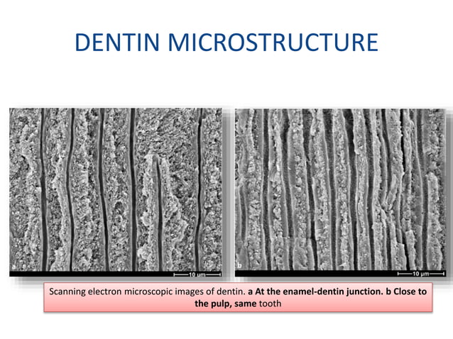 lec 1 Bonding to Dental Substrates or Adhesion.pptx