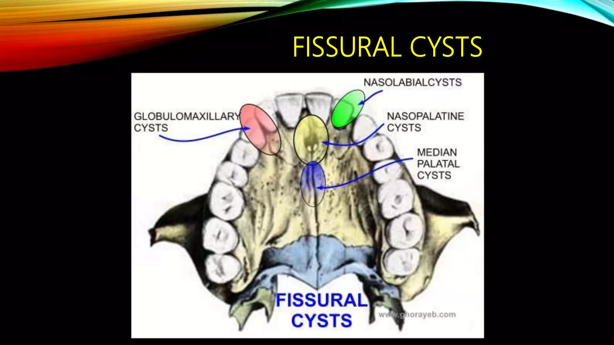 Lec 1 cysts of orofacial region | PPTX