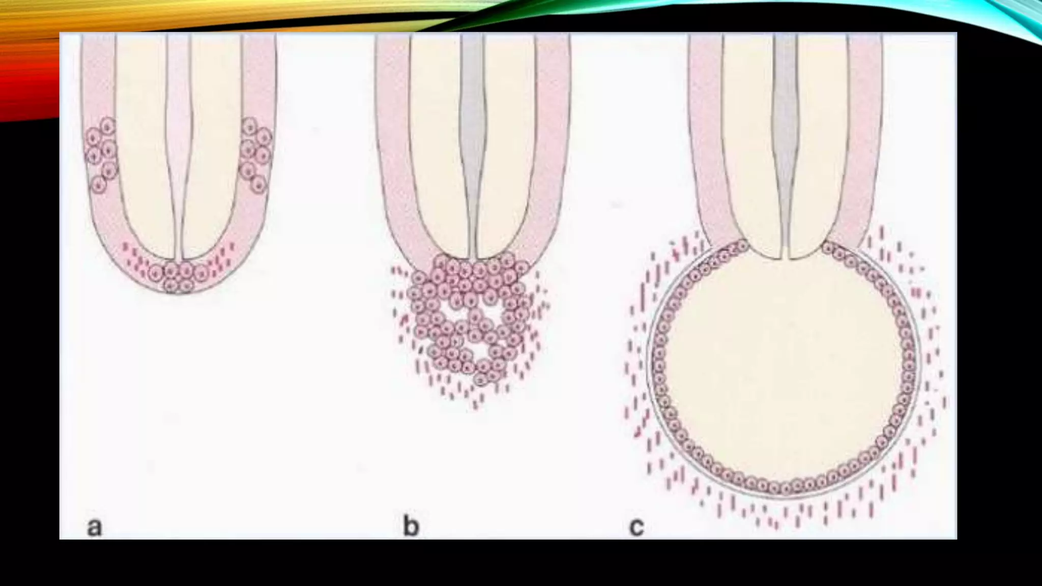 Lec 1 cysts of orofacial region | PPTX