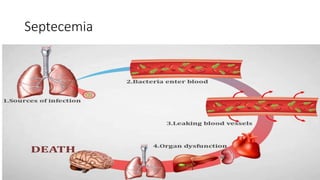 Lec 1 introd to infectious diseases | PPTX