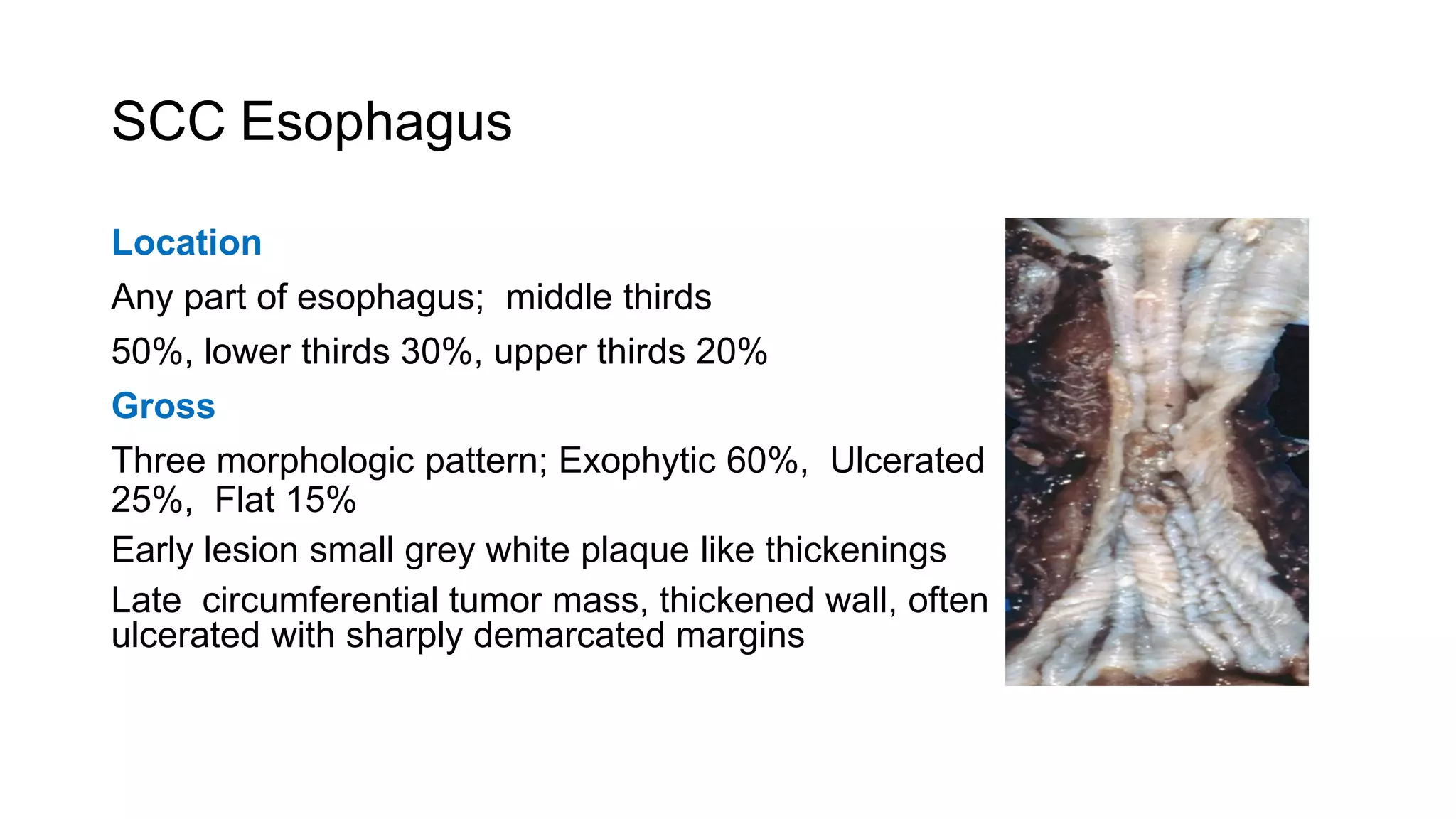 salivary gland and esophagus | PPTX