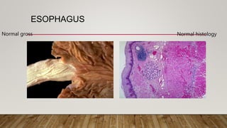salivary gland and esophagus | PPTX