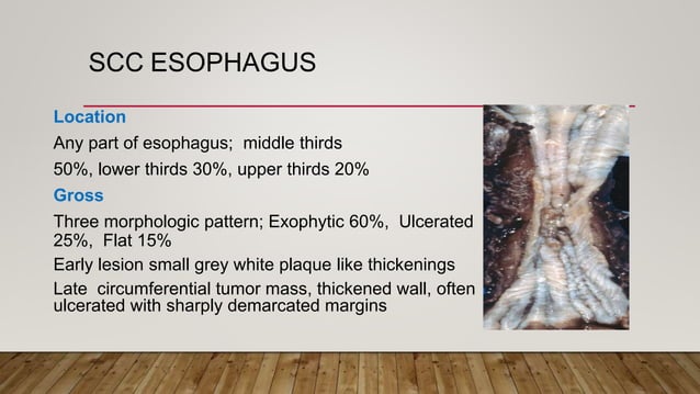 salivary gland and esophagus | PPT