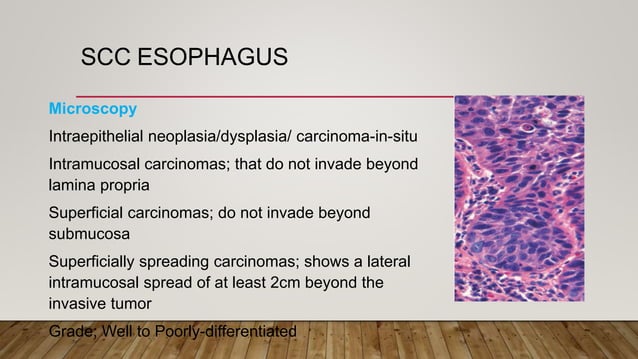 salivary gland and esophagus | PPT